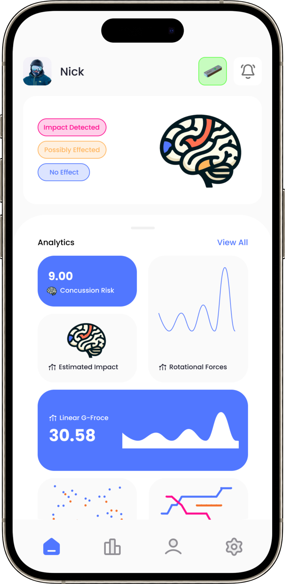 Phreno Concussion Sensor *PRE-ORDER